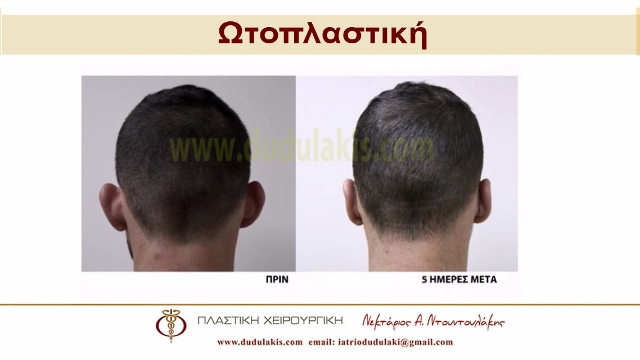 ΩΤΟΠΛΑΣΤΙΚΗ – Νεκτάριος Α. Ντουντουλάκης
